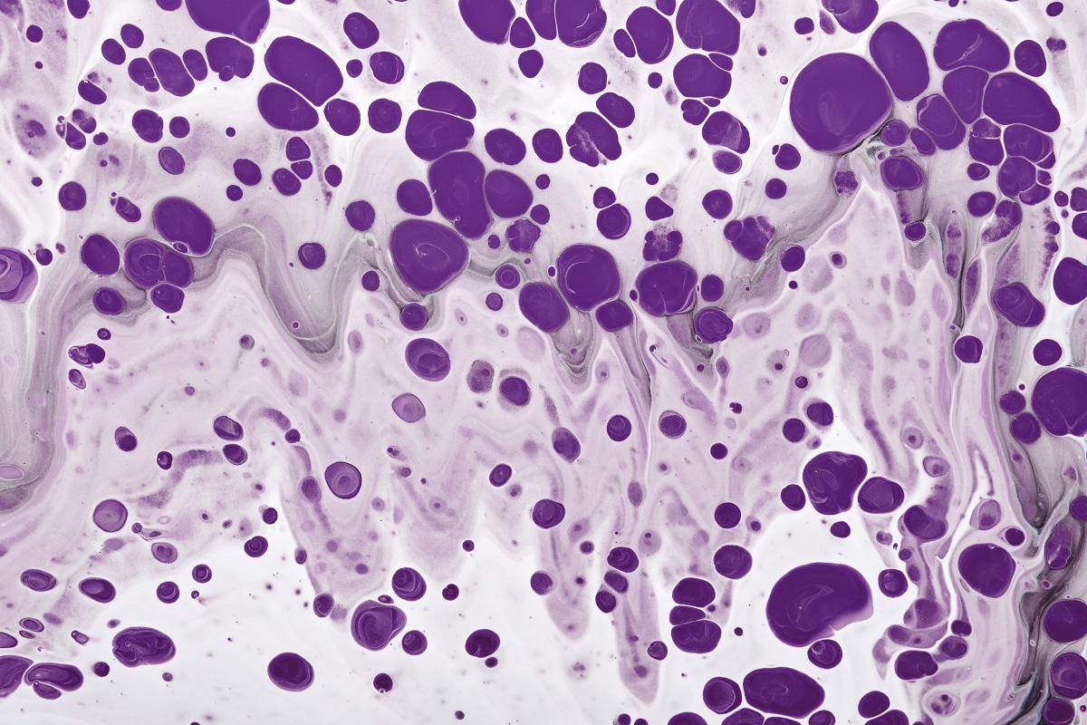 Sentinel Lymph Node Biopsy: Procedure, Risks, and Benefits - Benrus ...